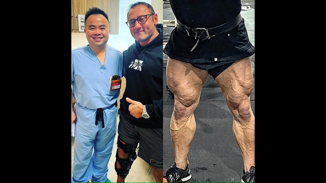 Quad surgery recovery update - YouTube