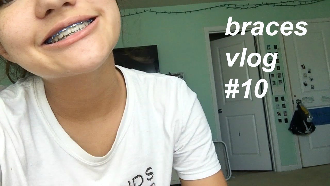 braces vlog #10 // infinityalanaxx - YouTube