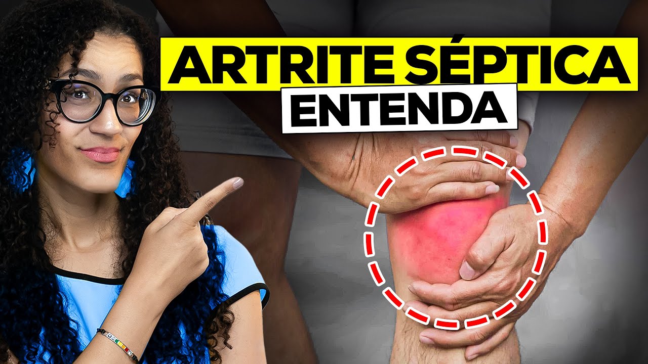 Artrite Séptica - Sintomas e Diagnóstico da Artrite Infecciosa - YouTube