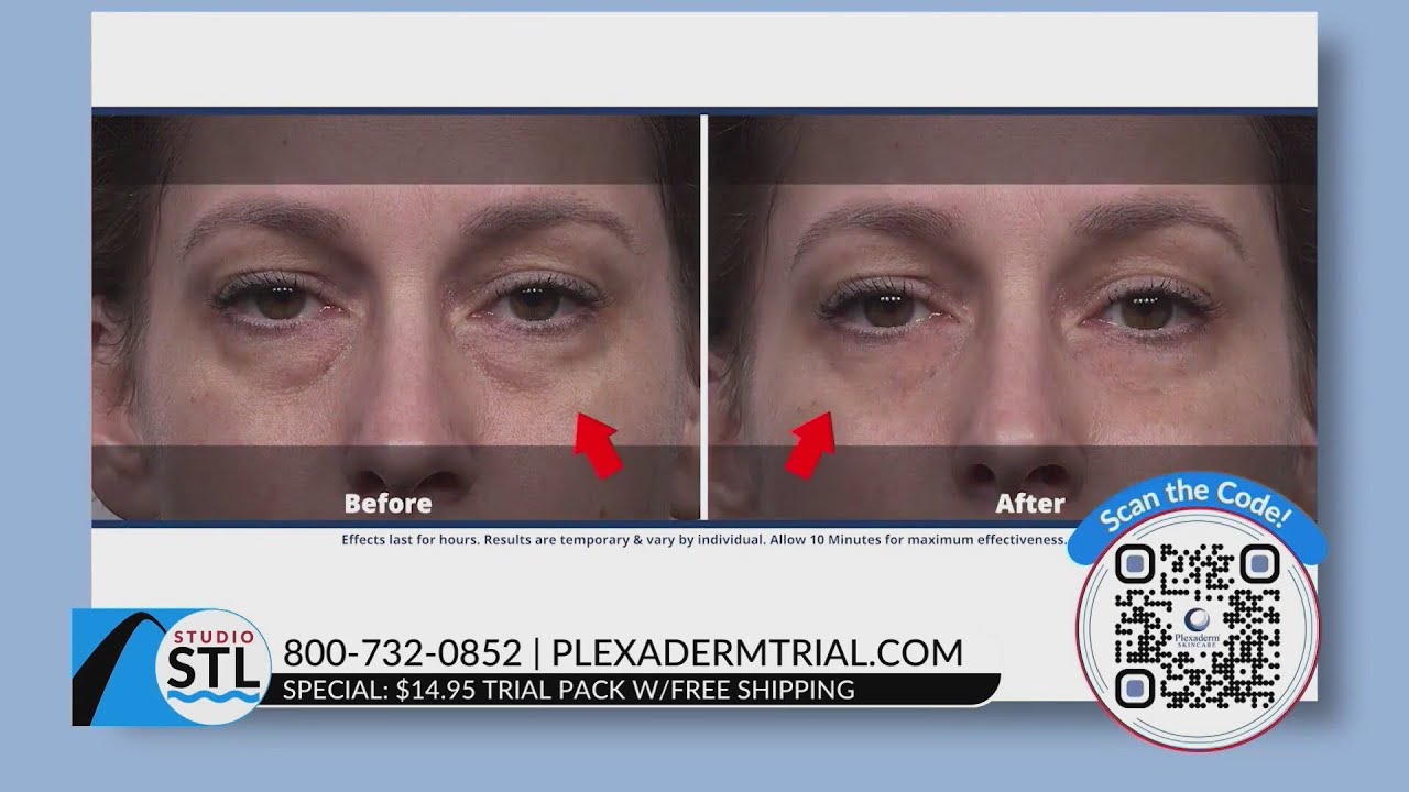 Take the Plexaderm 10-minute challenge for glowing skin! - YouTube