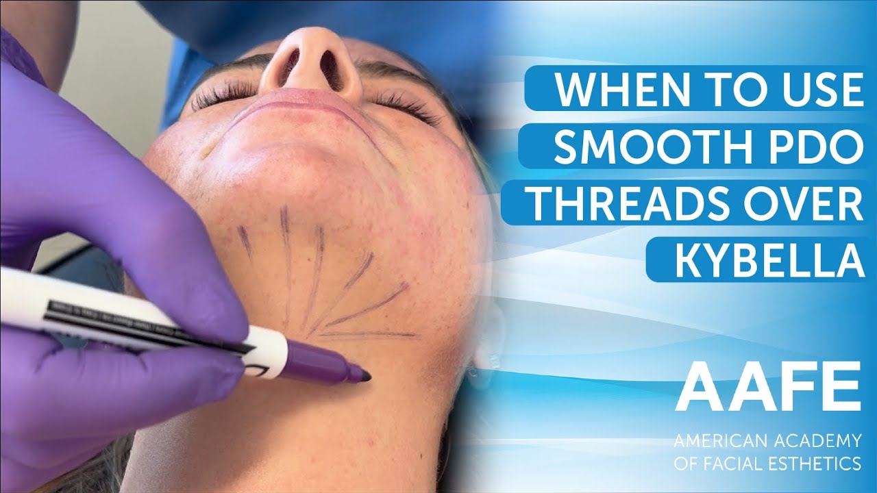 When to use Smooth PDO Threads Over Kybella - YouTube