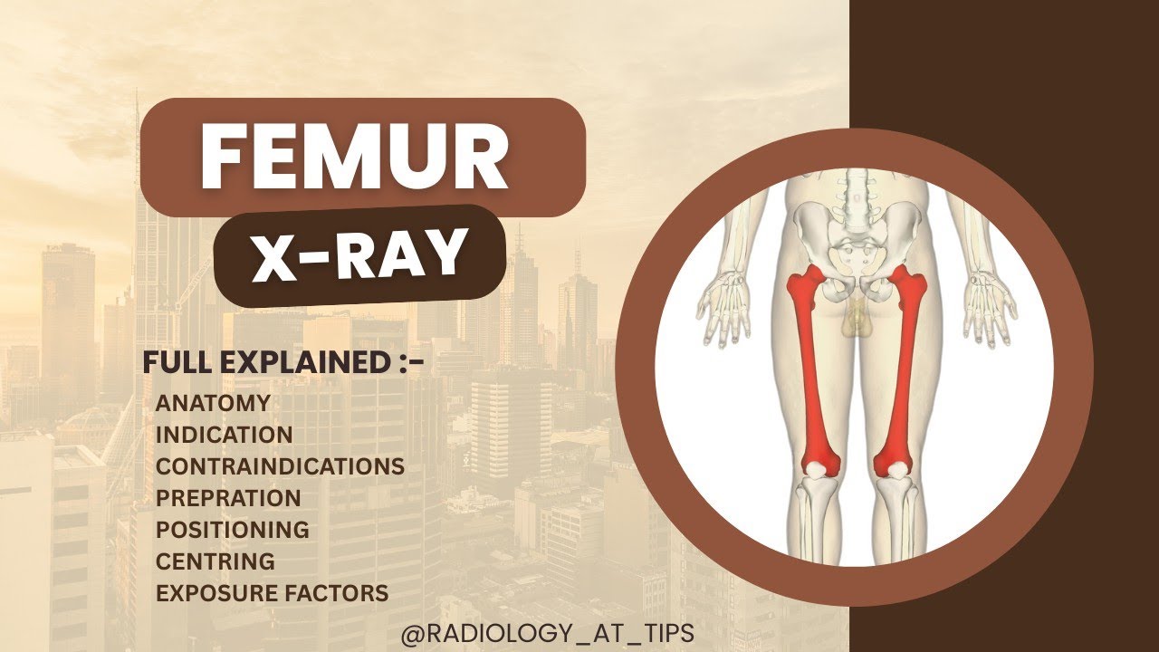 Femur X-ray Complete Guide | Easy Explanation for Radiography Students ...