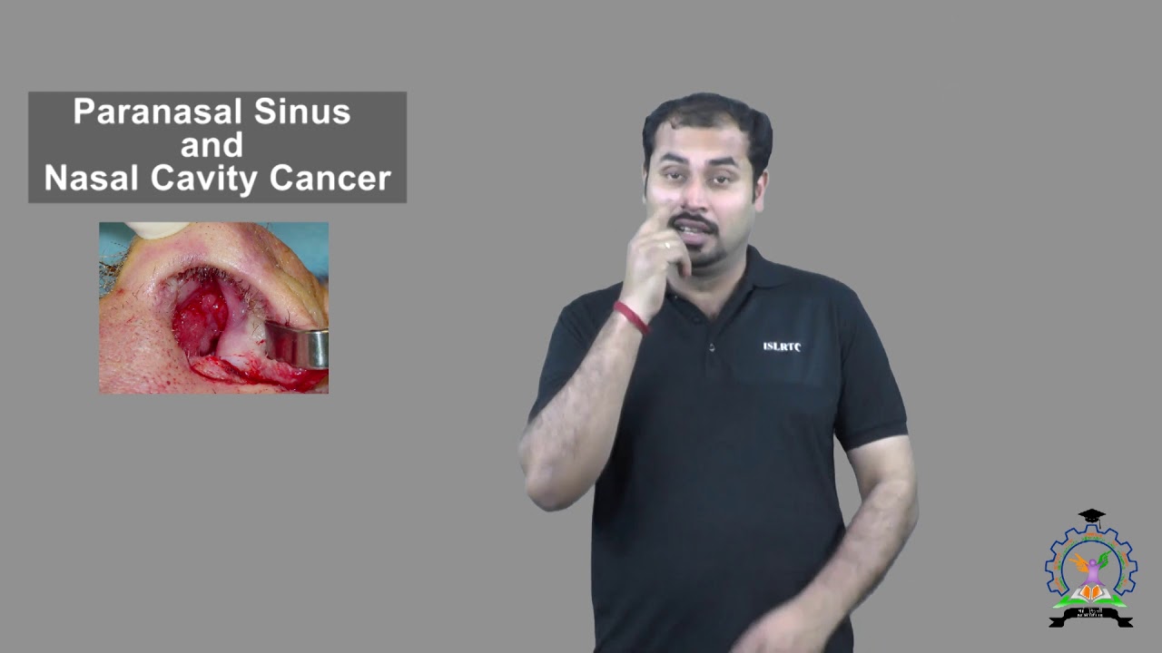 Paranasal Sinus and Nasal Cavity Cancer - YouTube