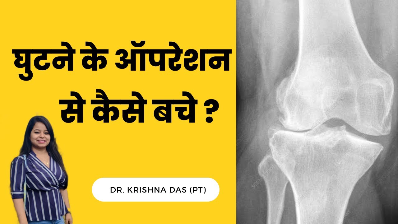 Ghutne ke operation se kaise bache | How to avoid Knee Replacement ...