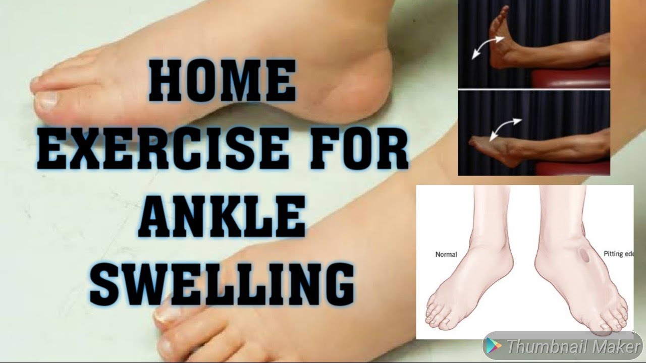 Exercise for Ankle Swelling. पैर की सूजन के लिए सरल व्यायाम। - YouTube
