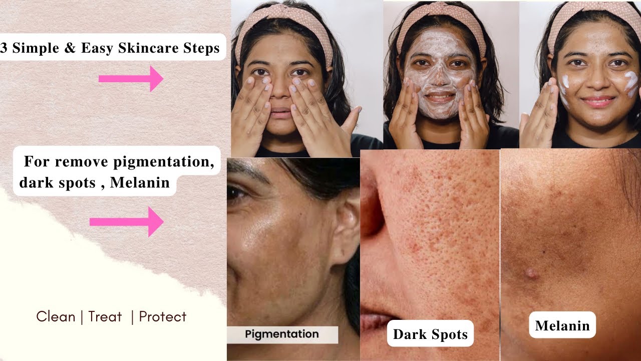 3 Simple & Easy Skincare Steps For Pigmentation , Dark Spots , Uneven ...