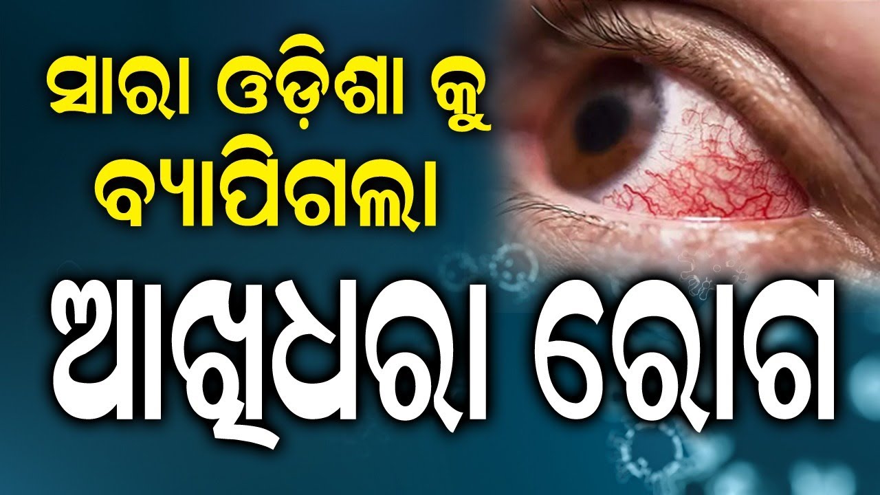 Understanding Common Eye Diseases : Causes, Symptoms and Treatments ...