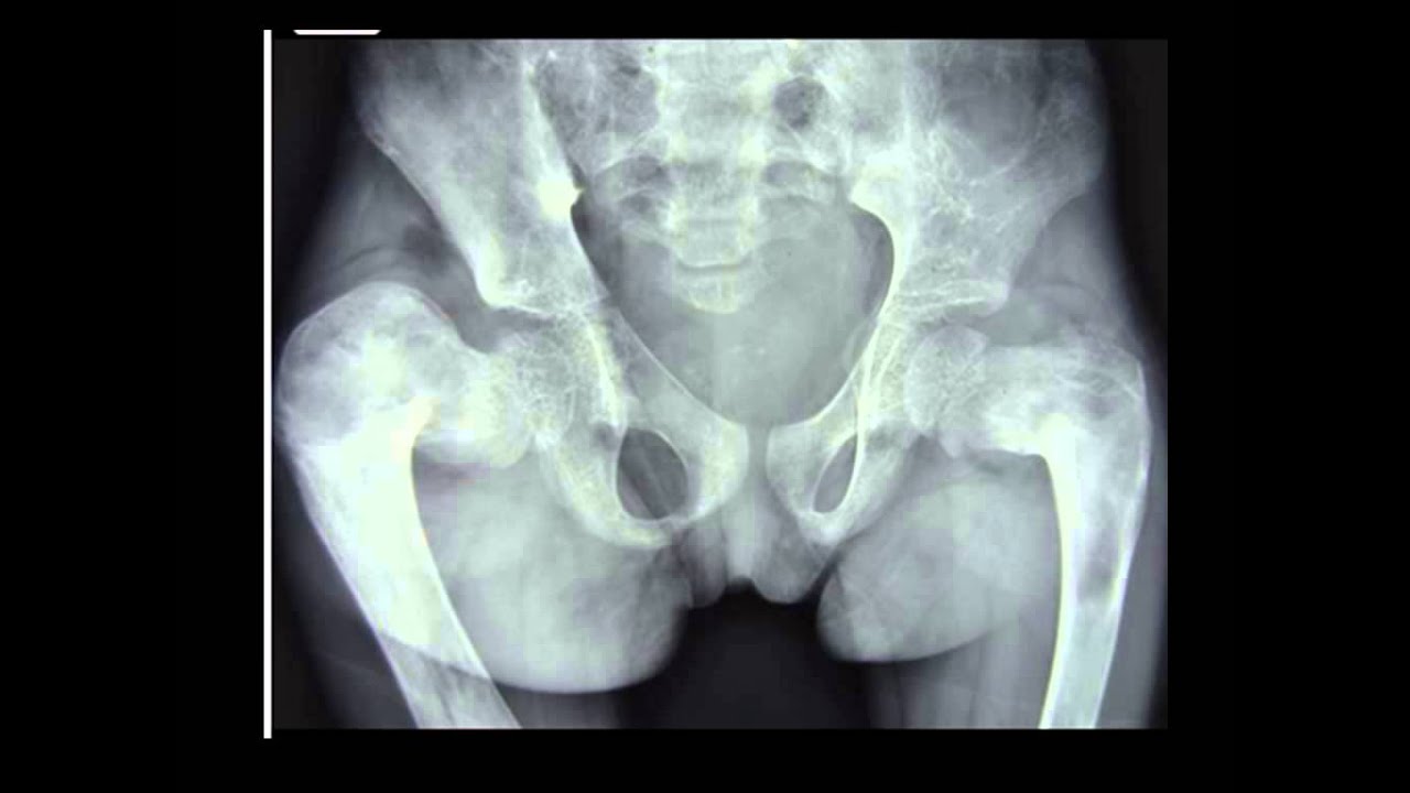 MSK IMAGING CASES 2015 PART 1 DR. AMR SAADAWY - YouTube