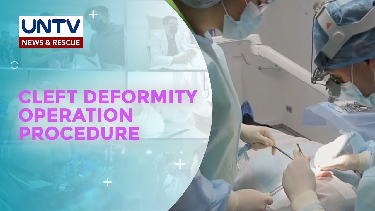 Operation procedure para sa mga may cleft deformity , may special ...