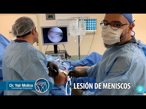 CIRUGÍA ARTROSCOPICA DE RODILLA - LESIÓN DE MENISCO - YouTube