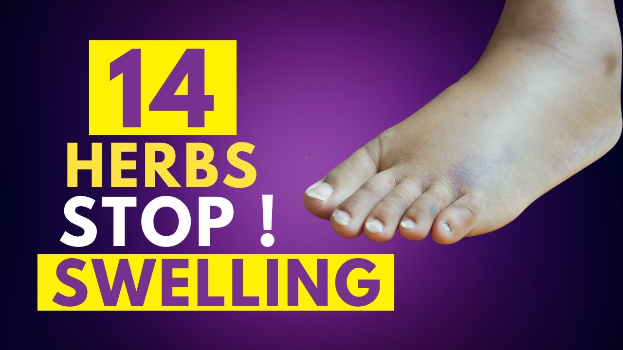 14 MAGICAL Herbs to Supercharge Your Leg Circulation QUICK! ( Fight ...