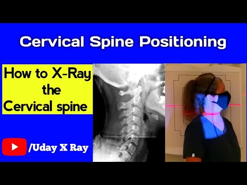 Cervical Spine X-ray Positioning | AP & Lateral View | Uday X Ray - YouTube