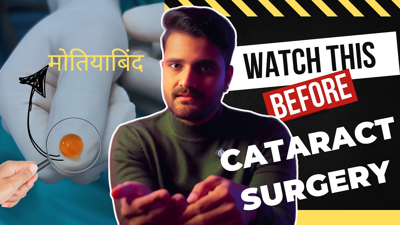 *5 Myths About Cataract Surgery You Need to Know* - YouTube