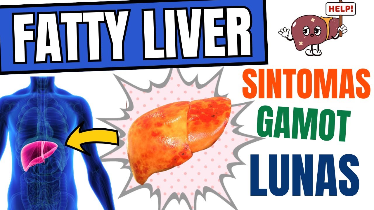 FATTY LIVER - Gamot at LUNAS | Sintomas, Mga BAWAL at DAPAT Kainin sa ...