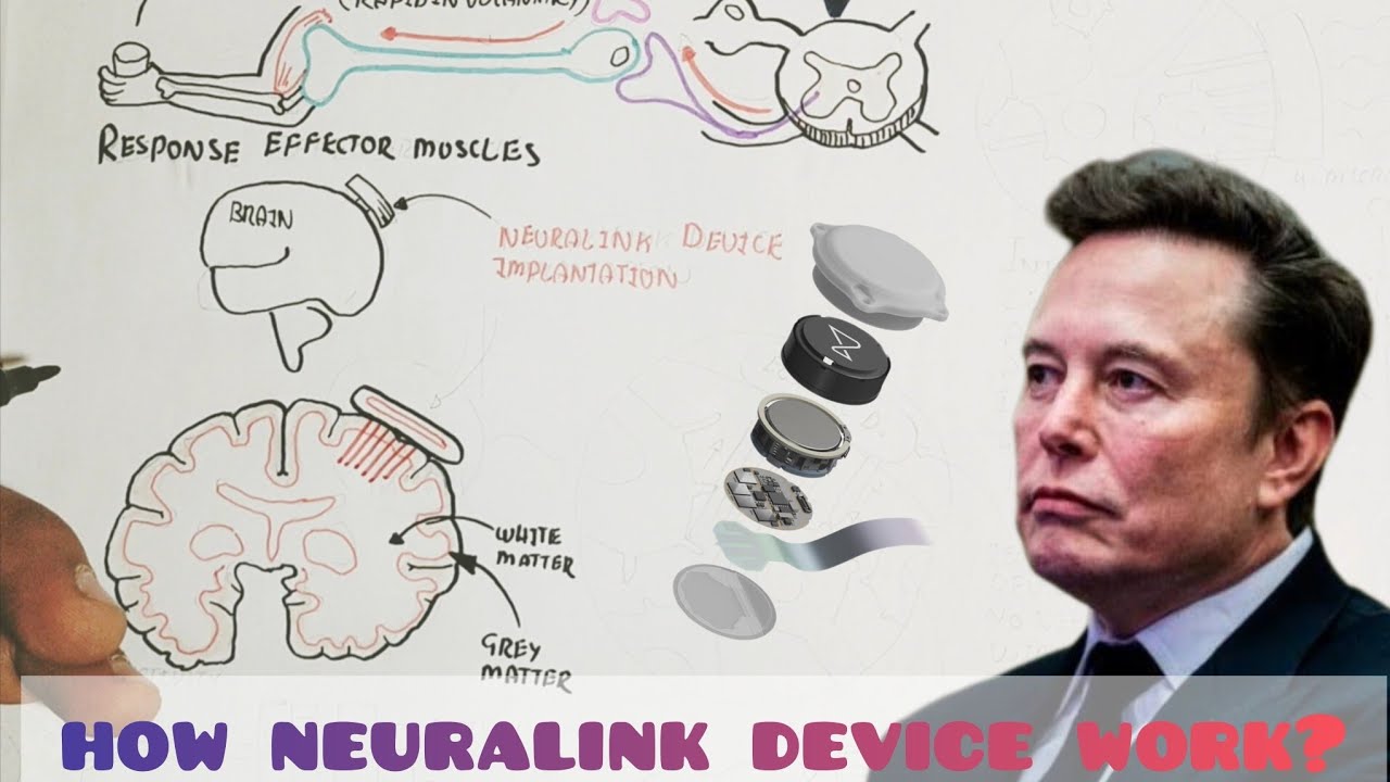 How Neuralink Device Work In Our Brain? - YouTube