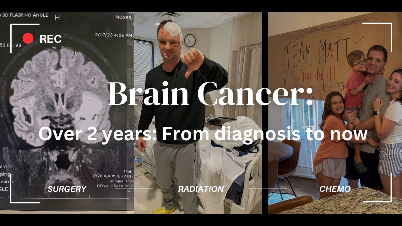 2 Years of Brain Cancer Treatment: From Diagnosis to now - YouTube