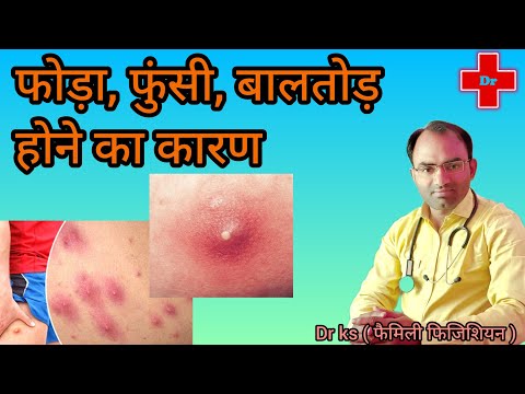 foda funsi ka ilaj l foda funsi ke lakshan l baaltod ka ilaj kese kare l