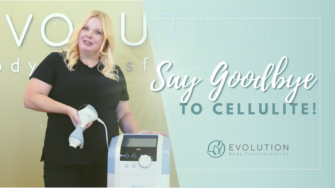 EMTONE AT EVOLUTION | How To Reduce CELLULITE - YouTube