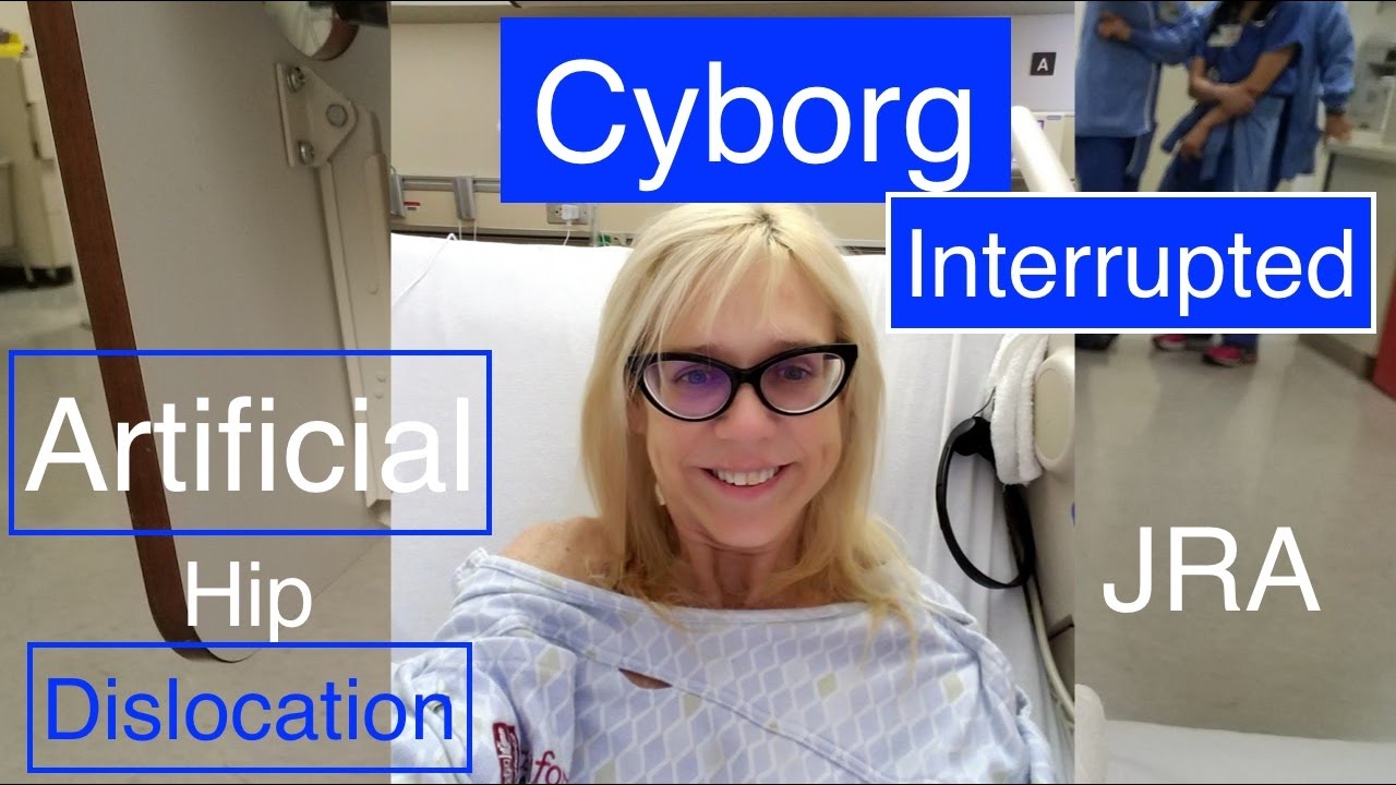 Cyborg Interrupted: Artificial Hip Dislocation JRA - YouTube