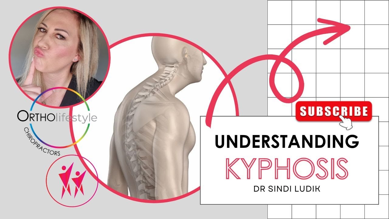 ORTHOlifestyle - Understanding Kyphosis - YouTube