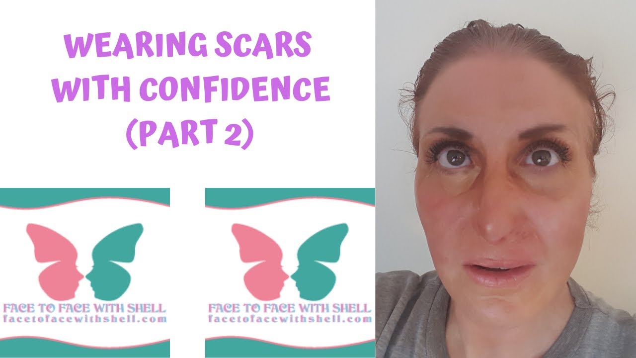 WEARING SCARS WITH CONFIDENCE (PART 2) - YouTube
