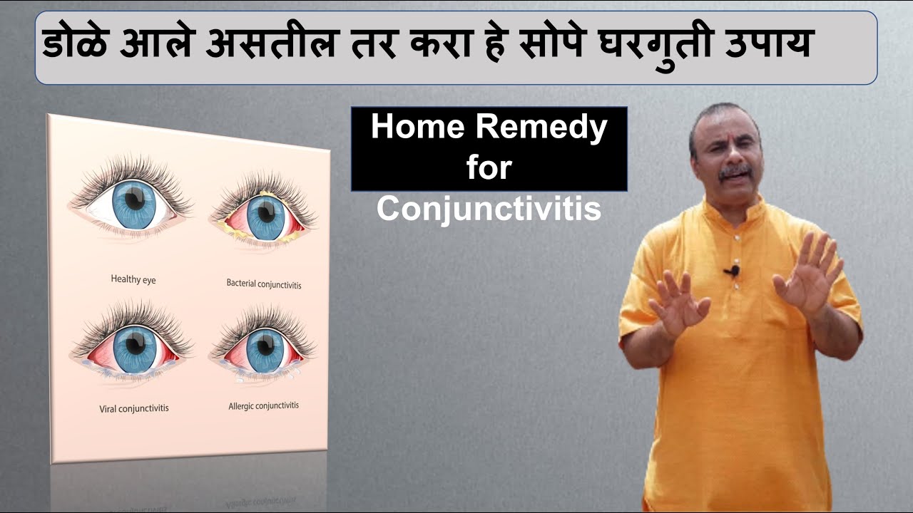 डोळे येणं हे वायरल इन्फेकशन, गोळ्यांनी जात नाही त्यासाठी हे उपाय करा ...