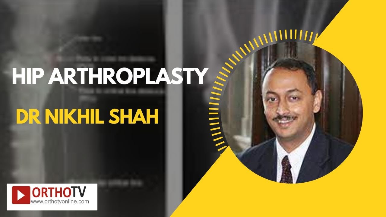 Hip Arthroplasty by Dr Nikhil Shah - YouTube