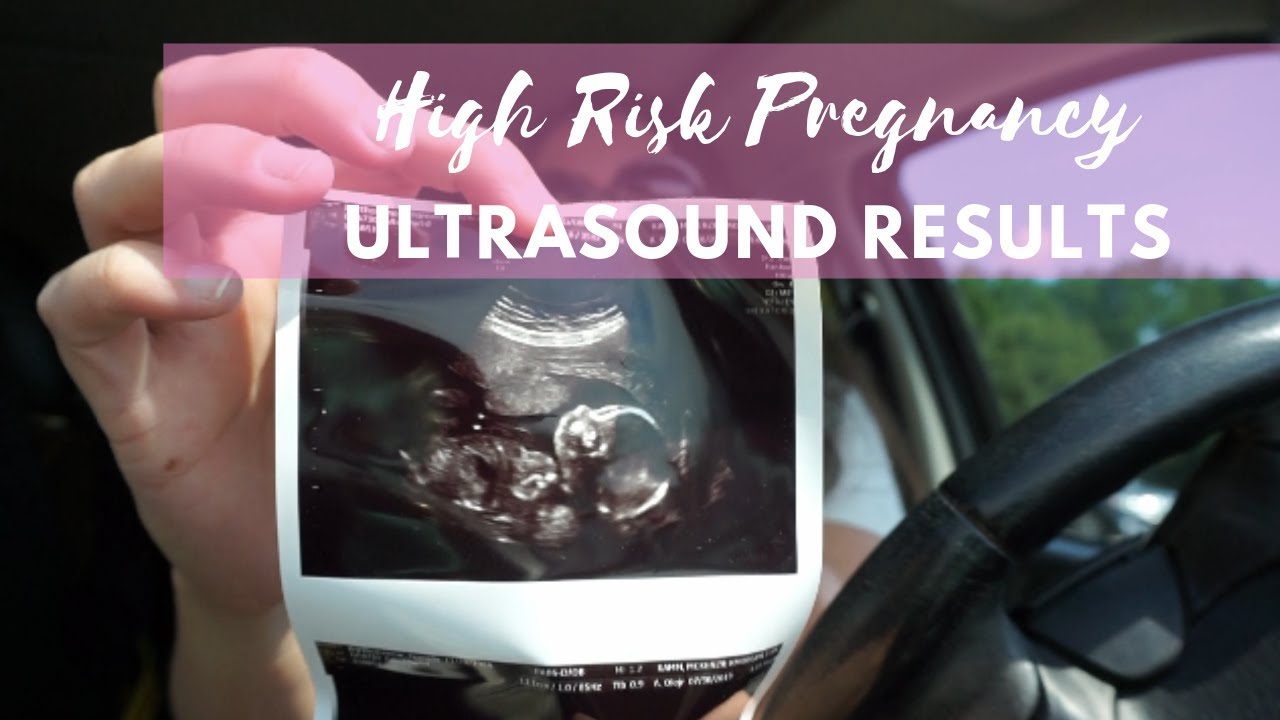 High Risk Pregnancy | Level 2 Ultrasound & Placenta Previa Concerns ...