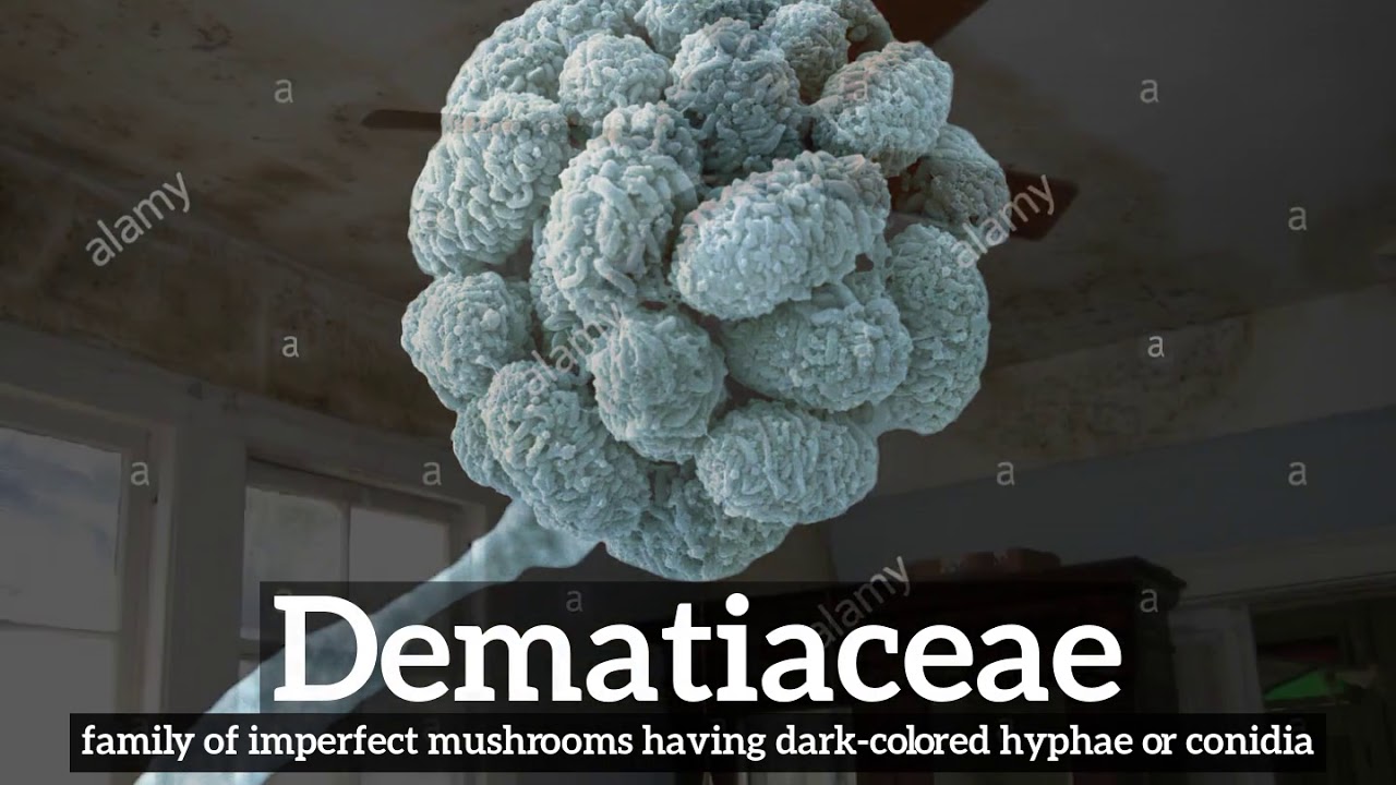 How Does Dematiaceae Look? | How to Say Dematiaceae in English? | What ...