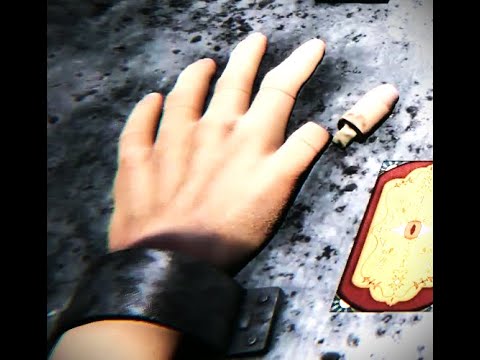 I had to cut off my fingers... - YouTube