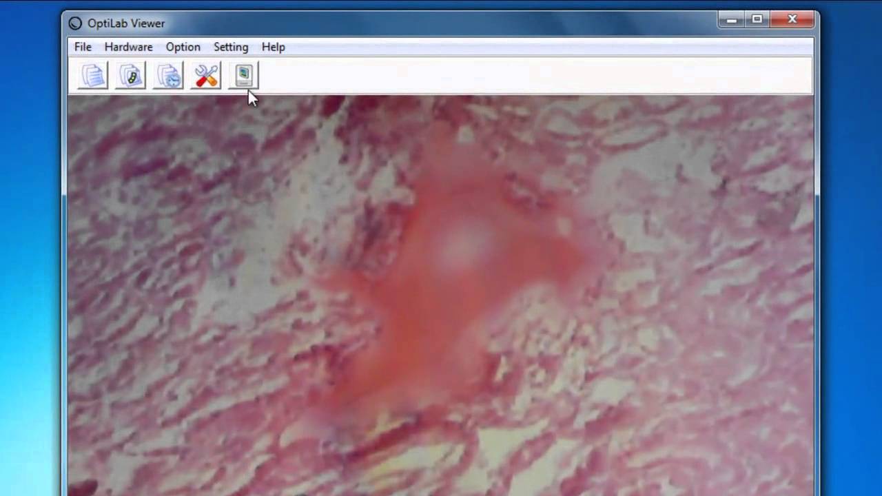 4.optilab viewer Optilab- Mikroskop Digital.mpg - YouTube