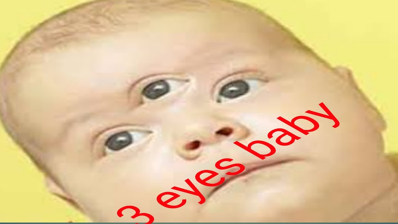 3 eyes baby 🤔🤔🤔🤔🤔🤔🤔 - YouTube