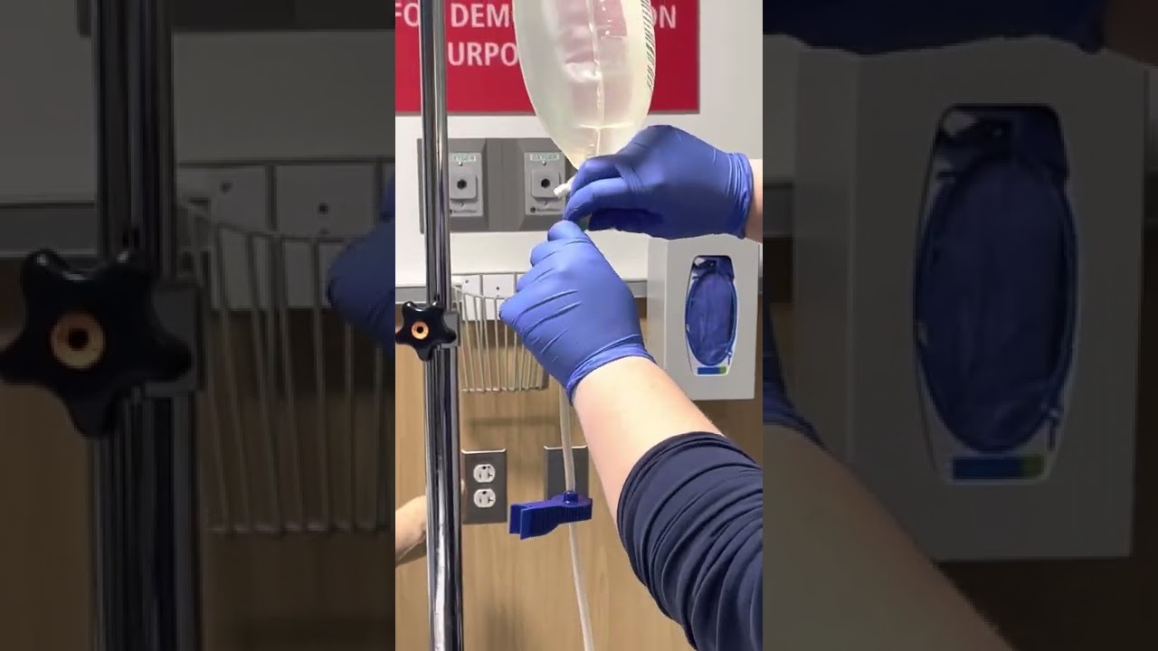 Continuous Ambulatory Peritoneal Dialysis (CAPD) Using the Ultrabag ...