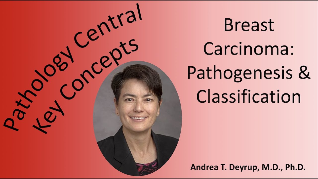 Medical School Pathology: Breast Cancer Pathogenesis & Classification ...