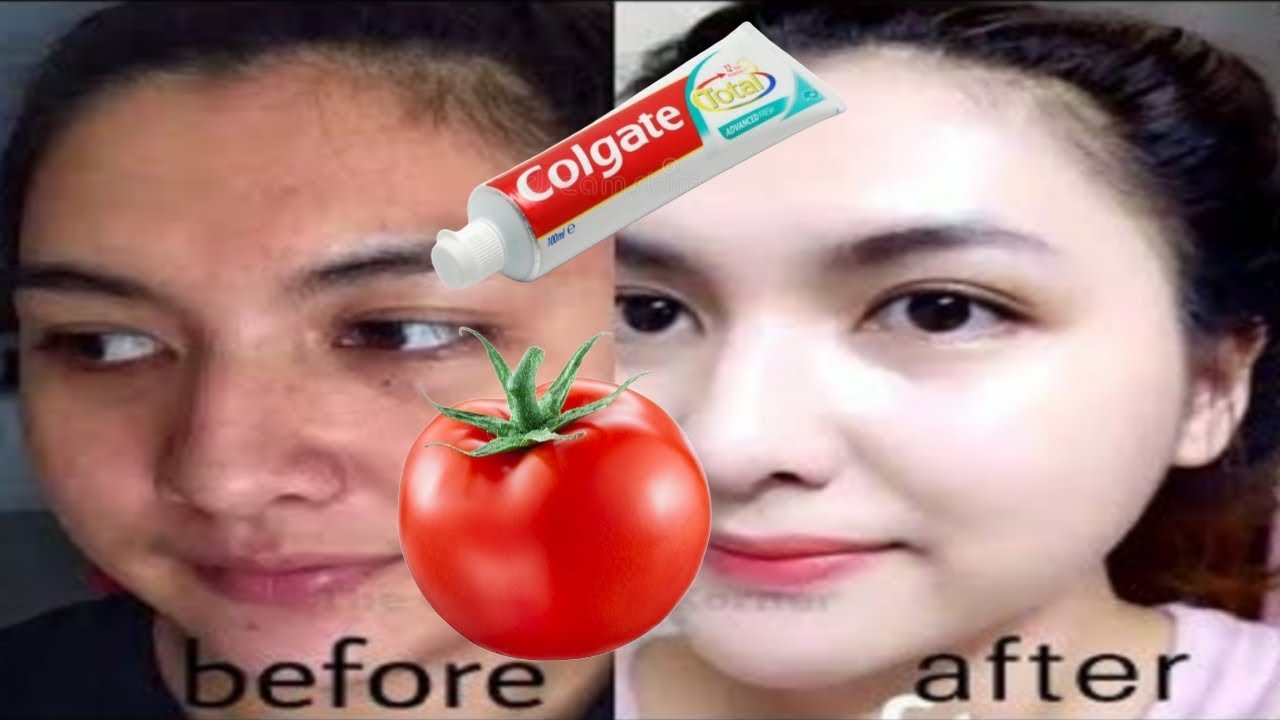 Mix tomato and toothpaste! Skin whitening and anti wrinkle mask! - YouTube