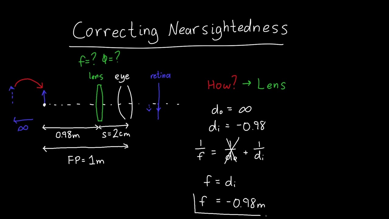 Correcting Nearsightedness using the Far Point - YouTube
