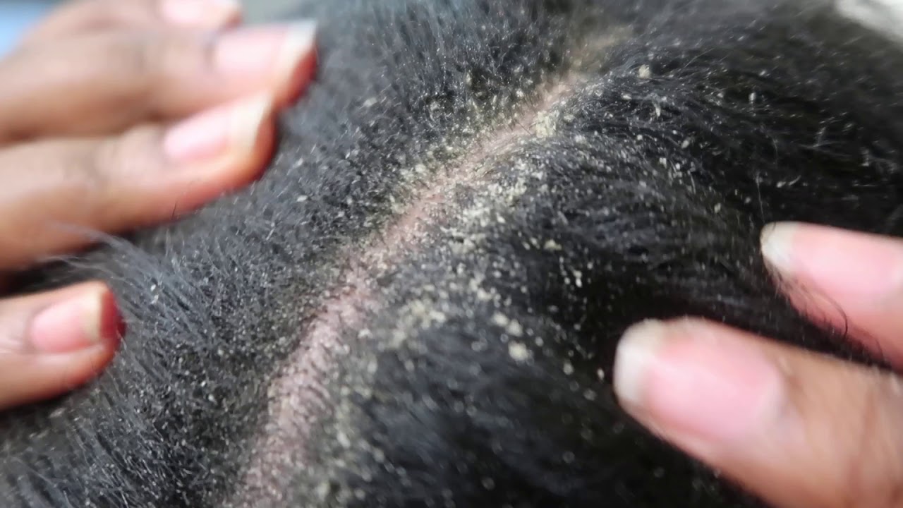Scratching From The Scalp - YouTube