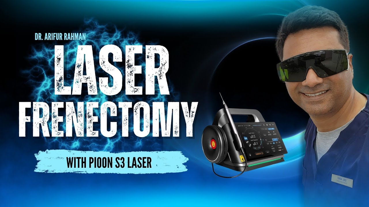 Laser Frenectomy | Pioon S3 dental laser - YouTube