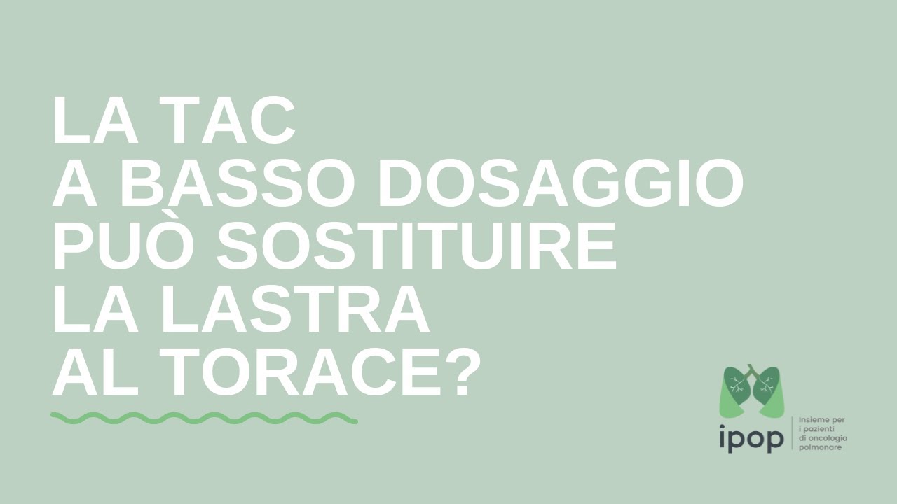 La TAC a basso dosaggio può sostituire la lastra al torace? - YouTube