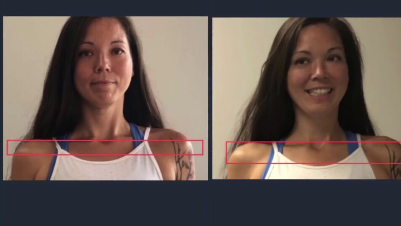 Feisty Beth Full Body Adjustment S1:E8 Watching Your Back - YouTube