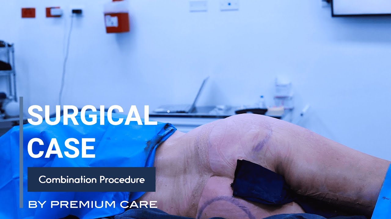 How Painful Is A Body Lift at Vikki Kearney blog