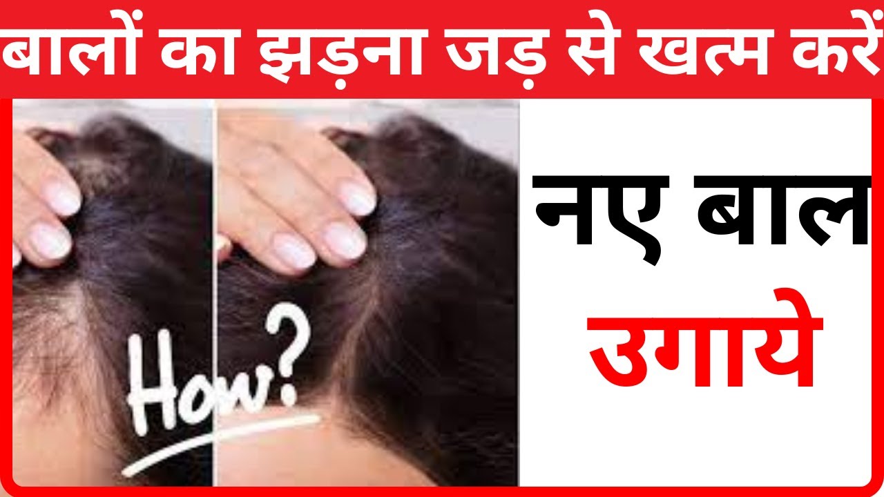 बालों का झड़ना जड़ से खत्म करें | Balo Ka Jhadna Kaise Roke | Kaise ...