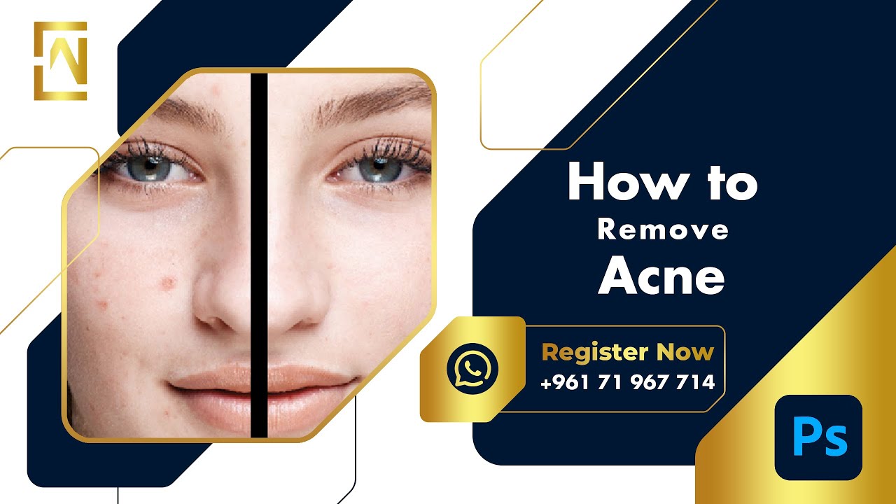 Photoshop Tutorial - How to Remove Acne & Skin Blemishes - YouTube