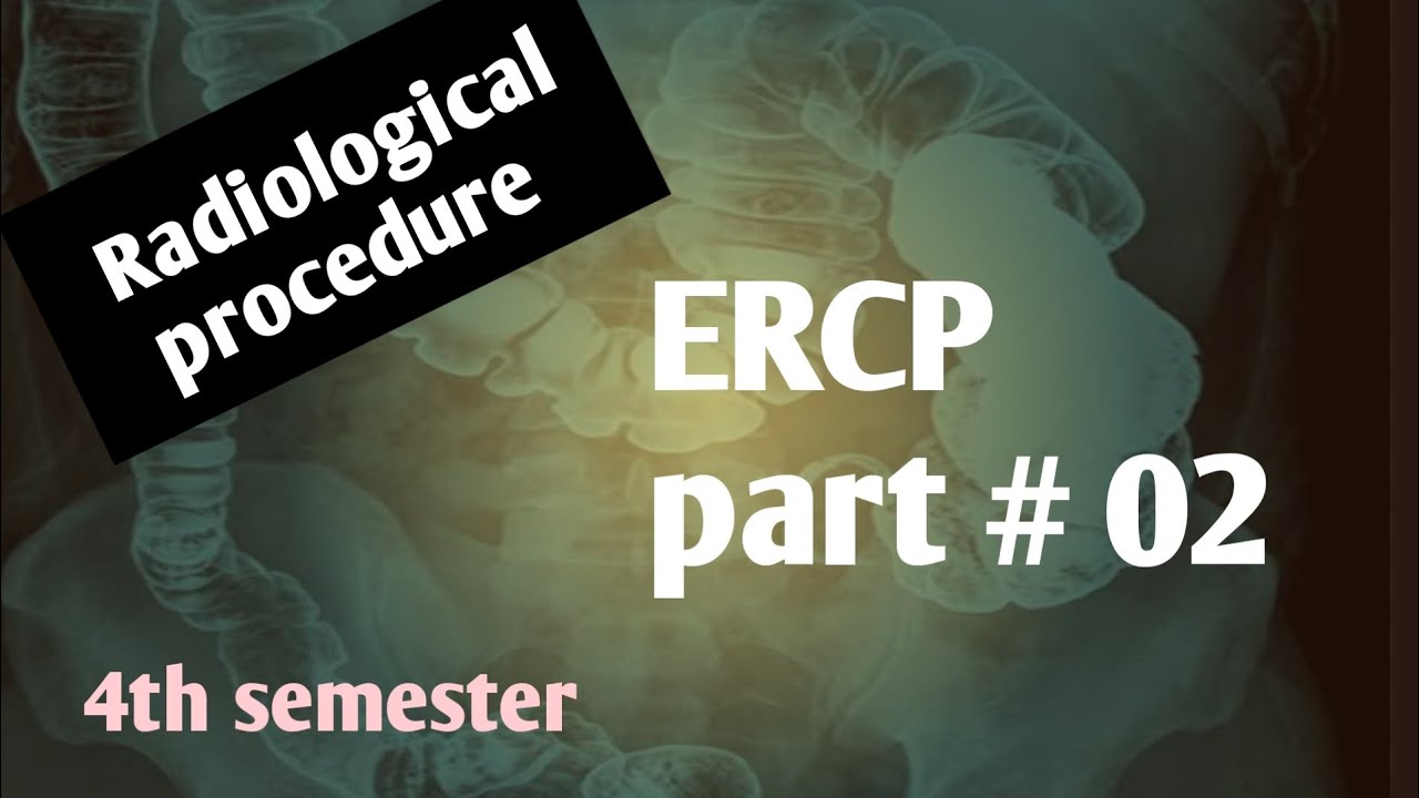 Endoscopic retrograde cholangiopancreatography/ERCP/technique/part#02/procedure - YouTube