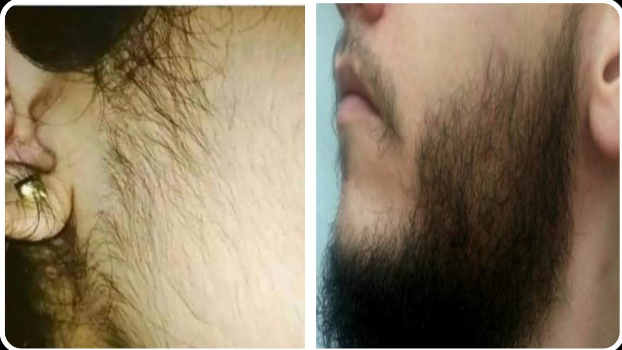 dadhi ghani karne ke upaye | best treatment for full beard ! - YouTube