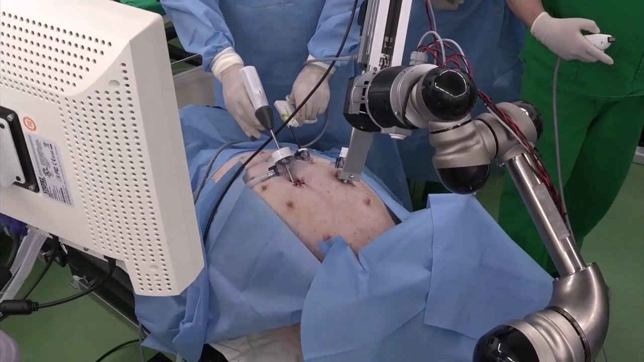 Surgical Assistant Robot for Laparoscopic Surgery - YouTube