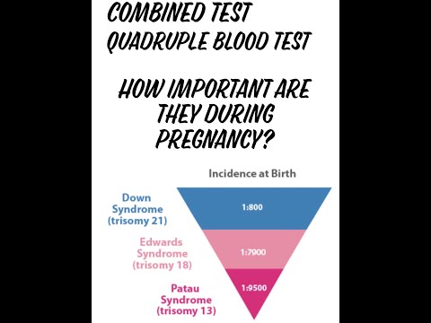Down Syndrome test during pregnancy | Benefits of GENETIC TESTING in ...