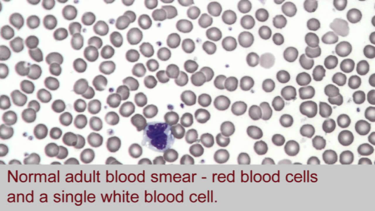 Automated Blood Analyser: Part 7 Blood Smear - YouTube