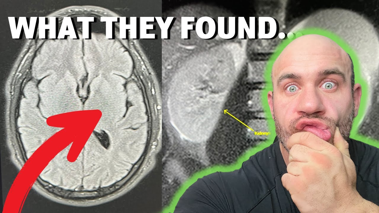 I DID A WHOLE BODY MRI SCAN YouTube i-did-a-whole-body-mri-scan-youtube