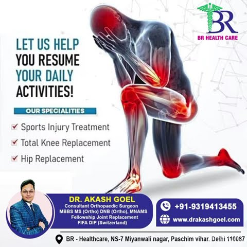 Dr. Akash Goel - Best Orthopaedic Doctor in Delhi. - YouTube
